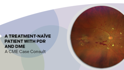 A Treatment-Naïve Patient With PDR and DME – Case Consult - DME