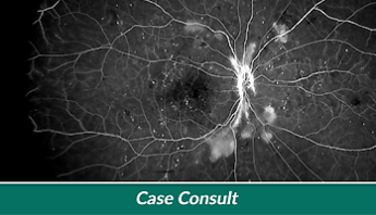 Patient With Diminished Visual Acuity and Persistent DME Despite ...